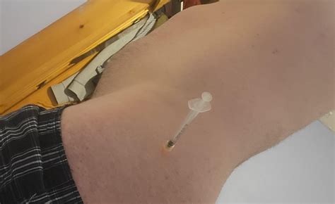 Ventrogluteal Injection Help R Trt