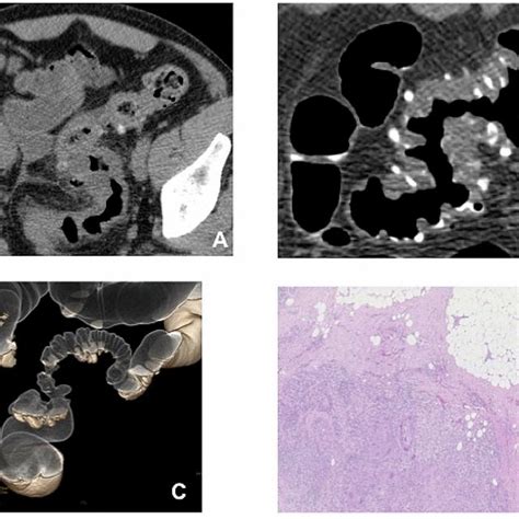 Sample Ct Colonography Radiation Dose Summary Page The Total Exam Dose Download Scientific