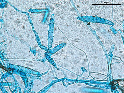 Microsporum Canis Macroconidia