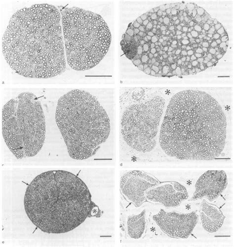 Figure 10 From The Spinal Nerve Roots Semantic Scholar