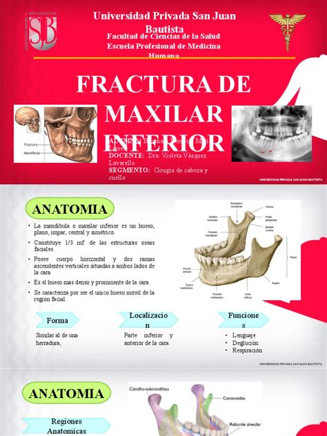 Fractura De Maxilar Inferior Pdf Medicina Clinica