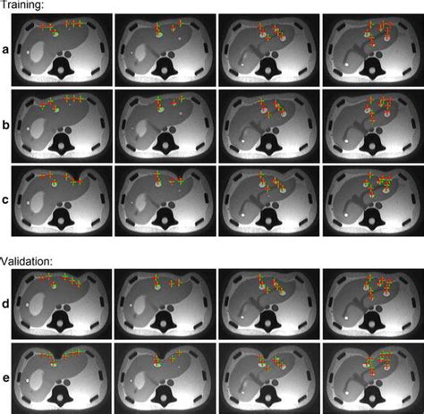 Parameters Estimation And Validation Of Personalized Heterogeneous Download Scientific Diagram