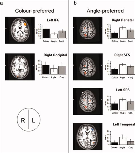 Plots Of Beta Values Are Presented To Illustrate Activation Patterns Download Scientific