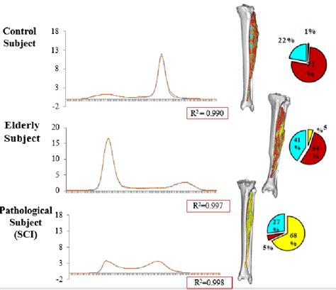Material Histogram Distribution Of The Right Leg Between All The