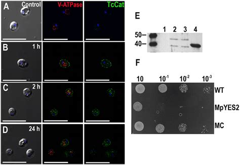 Functional Yeast Complementation With Tccat A D Tccat Expression As Download Scientific