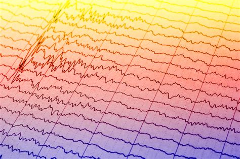 Understanding Spontaneous Brain Activity In Infants May Shed Light On