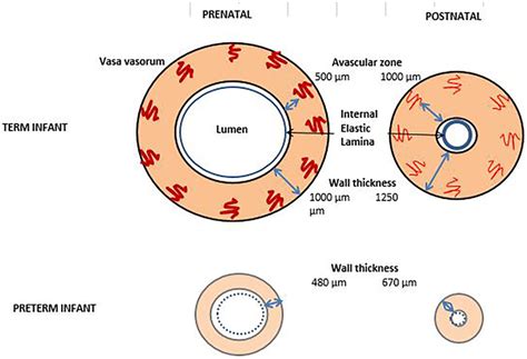 Vaso Vasorum In Term And Preterm Infants Before And After Birth By The Download Scientific