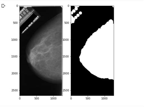 Python How To Remove Mammography Tag Artifacts Stack Overflow
