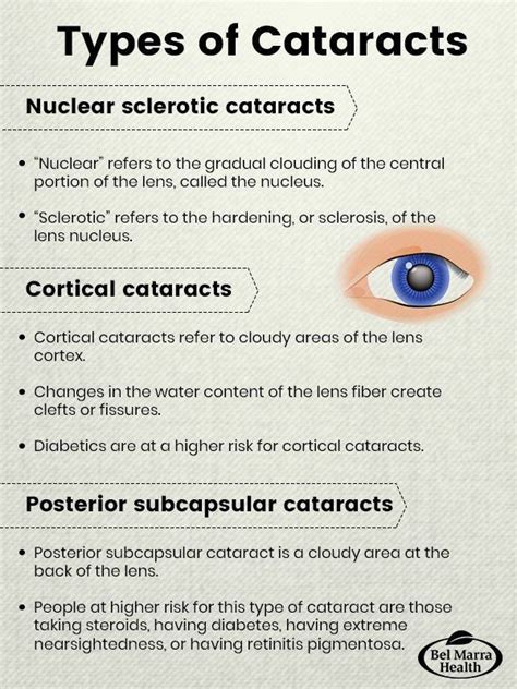 Types Of Cataract Artofit