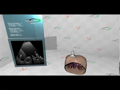 Simulate Ultrasound Images Within Unity Unity Engine Unity Discussions