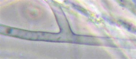 Pythium On Poa PACE Turf Photo Gallery