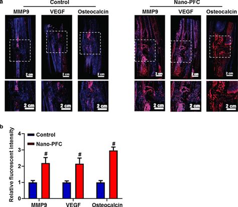 Immunofluorescent Analysis Of Fracture Zones After Nano Pfc Treatment Download Scientific