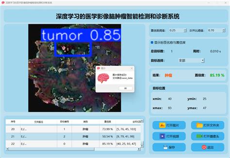 基于yolov8深度学习的脑肿瘤智能检测系统设计与实现pyqt5界面数据集训练代码基于yolov11的脑肿瘤 Csdn博客