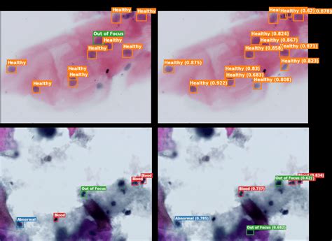 Predictions Using Mask R Cnn On Images Of The Test Set Download Scientific Diagram