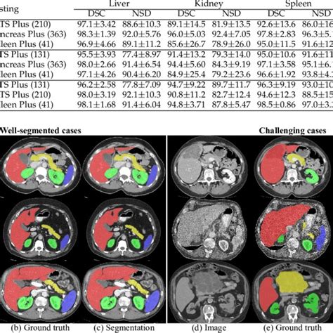 Pdf Abdomenct 1k Is Abdominal Organ Segmentation A Solved Problem