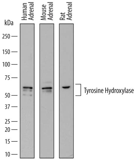 Tyrosine Hydroxylase