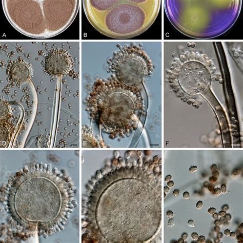 Aspergillus Violaceofuscus Ac Colonies Incubated At 25 °c For 7 D A
