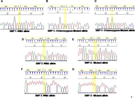 Electropherogram Representing A Wild Allele Of Snp1 In Healthy Subject