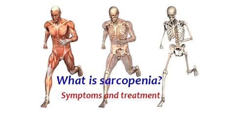 What Is Muscle Loss Sarcopenia Symptoms And Treatment