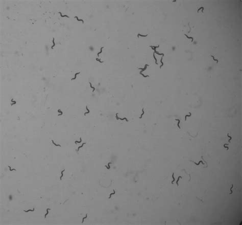 Input Scale · Talmolab Sleap · Discussion 1035 · Github