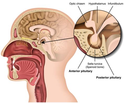 Pituitary Gland Disorders Treatment In Singapore Symptoms Causes