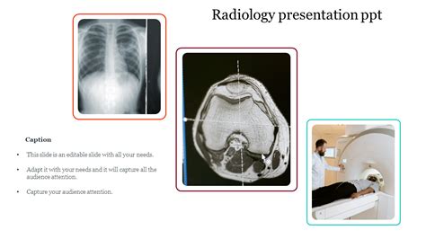 X Ray Ppt X Ray Ppt