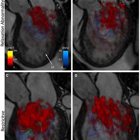 3d Volume Rendering Of Turbulent Kinetic Energy Tke Red In Early Download Scientific