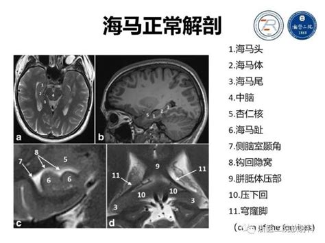海马体解剖图 千图网