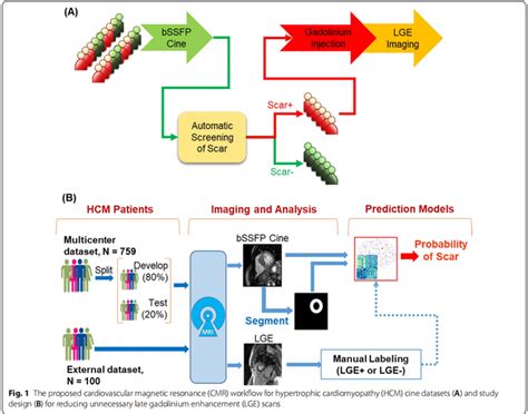 纯实操）平台实操讲解教程：放射组学和深度学习在肥厚型心肌病心肌瘢痕筛查中的应用 知乎