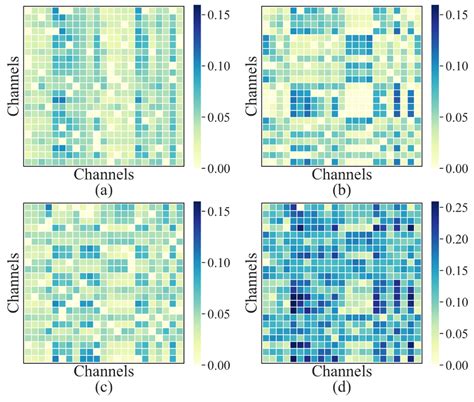 Automatic Seizure Detection Based On Stockwell Transform And Transformer