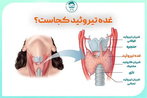 غده تیروئید کجاست؟ معرفی انواع بیماری‌های تیروئید دکترمایکو