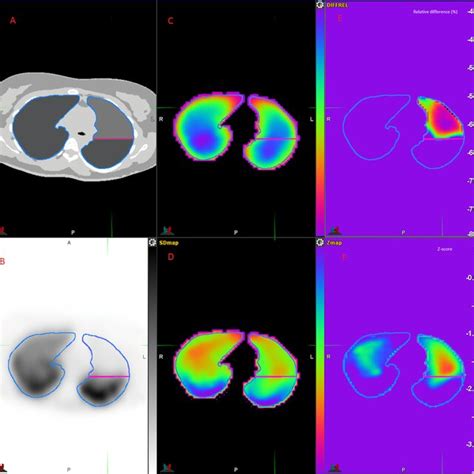 Example Of Simulated Pe With Corresponding Parametric Maps Digital Download Scientific Diagram