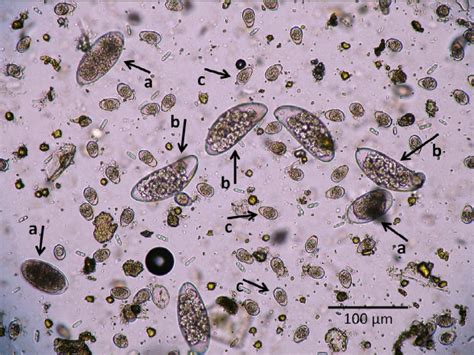 Nematode Eggs A Trichostrongylus Sp B Passalurus Ambiguous And Download Scientific