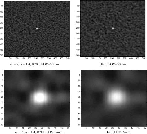 Figure 3 From Projection Space Denoising With Bilateral Filtering And