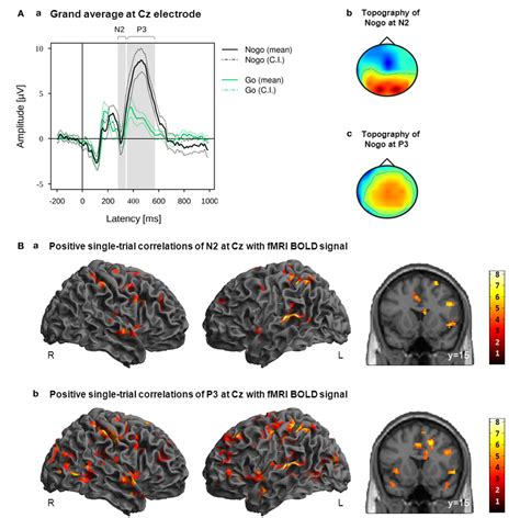 Figure From Data Driven Analysis Of Simultaneous EEG FMRI Using An ICA Approach Semantic Scholar