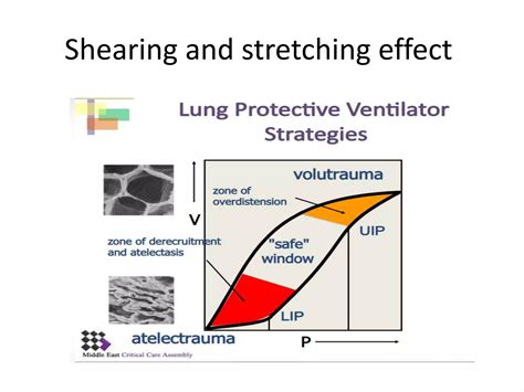 Part 7 Diseases Specific Ventilation Strategy Pptx