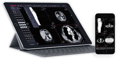 Visualization Web Application Meddream Softneta Medical Imaging