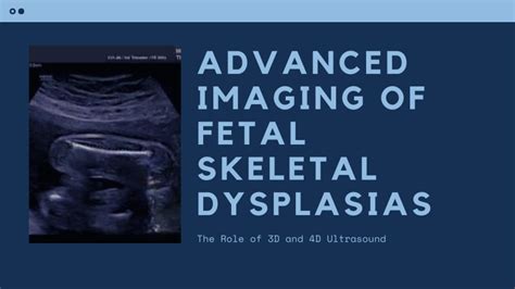 The Significance Of Short Long Bones In Fetal Anomaly Screening