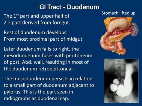 Anatomy Of Duodenum Duodenum Structure Ppt Of Duodenum Power Point