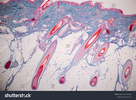 Scalp Hair Follicles Human Under Microscope Stock Photo 2163518701 Shutterstock