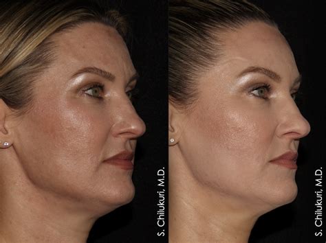 Results Archive Refresh Dermatology