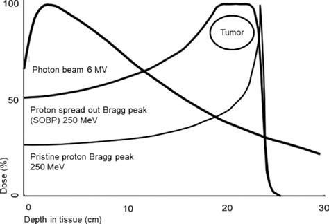 Proton Therapy For Patients With Esophageal Cancer History Characteristics Clinical Outcome