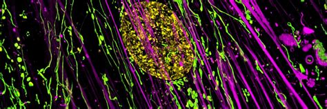 Ax Ax R With Nsparc Ax Ax R With Nsparc Confocal And
