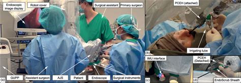 Figure 12 From Foot Controlled Robot Enabled Endoscope Manipulator Freedom For Sinus Surgery