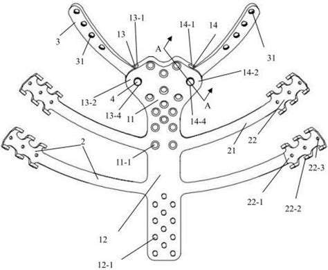Metal Breastbone Skeleton Device Eureka Patsnap
