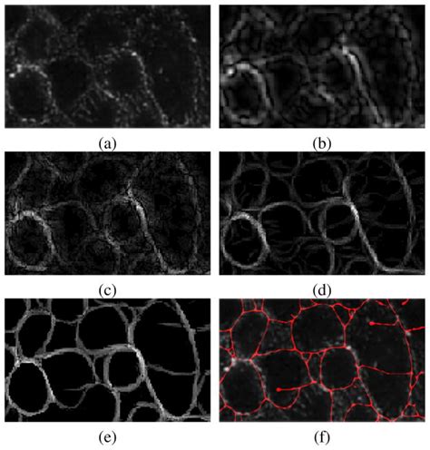 Iterative Tensor Voting For Perceptual Grouping Of Ill Defined Curvilinear Structures
