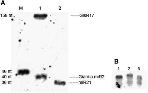 Simple And Nonradioactive Detection Of Micrornas Using Digoxigenin Dig Labeled Probes With