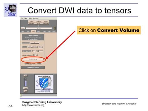 Diffusion Tensor Imaging Analysis 3749