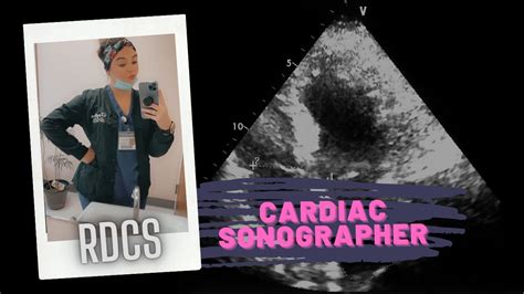 Life Of A Registered Diagnostic Cardiac Sonographer Echocardiography