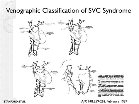 Σταύρος Σπηλιόπουλος Επ Καθηγητής ΕΚΠΑ Επεμβατικός Ακτινολόγος Ppt